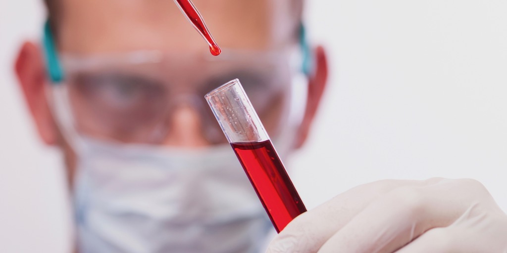 Laboratory chemicals & consumables | Chemlab-Analytical